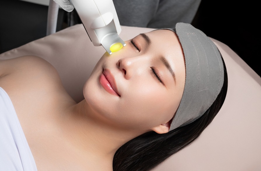 Active Acne Laser By Pro Yellow